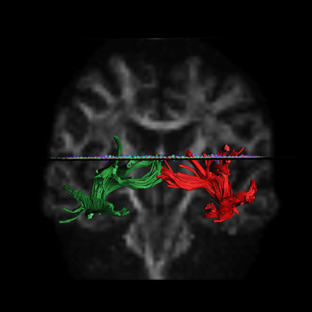 Neuroimaging - Center for Neurorestoration and Neurotechnology