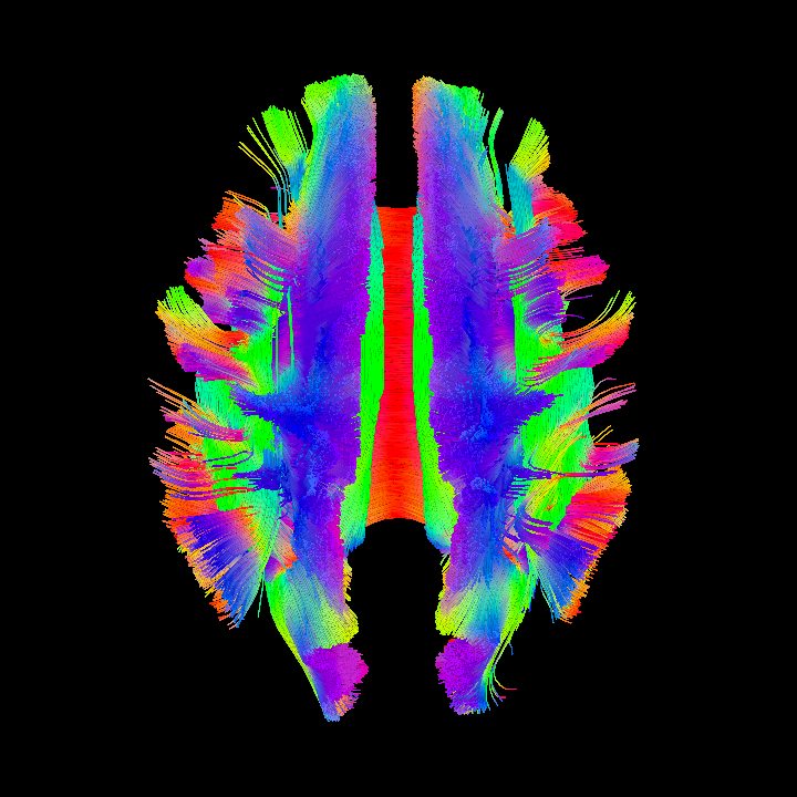 Neuroimaging - Center for Neurorestoration and Neurotechnology